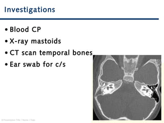 Acute mastoiditis lecture | PPT