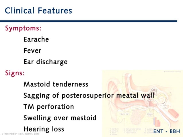 Acute mastoiditis lecture | PPT