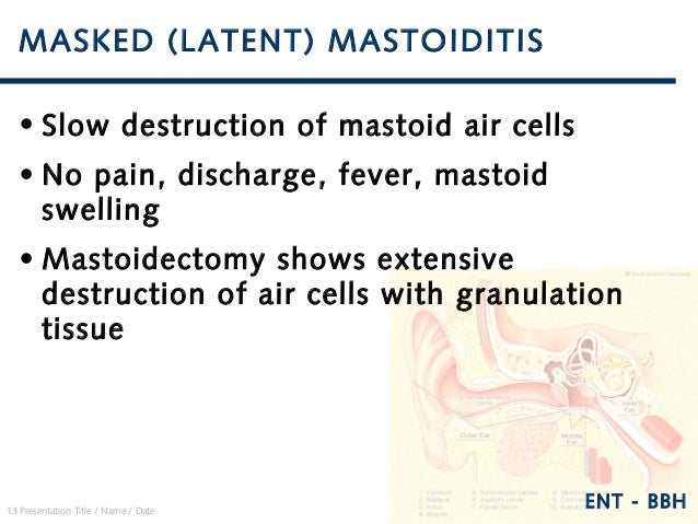 Acute mastoiditis lecture