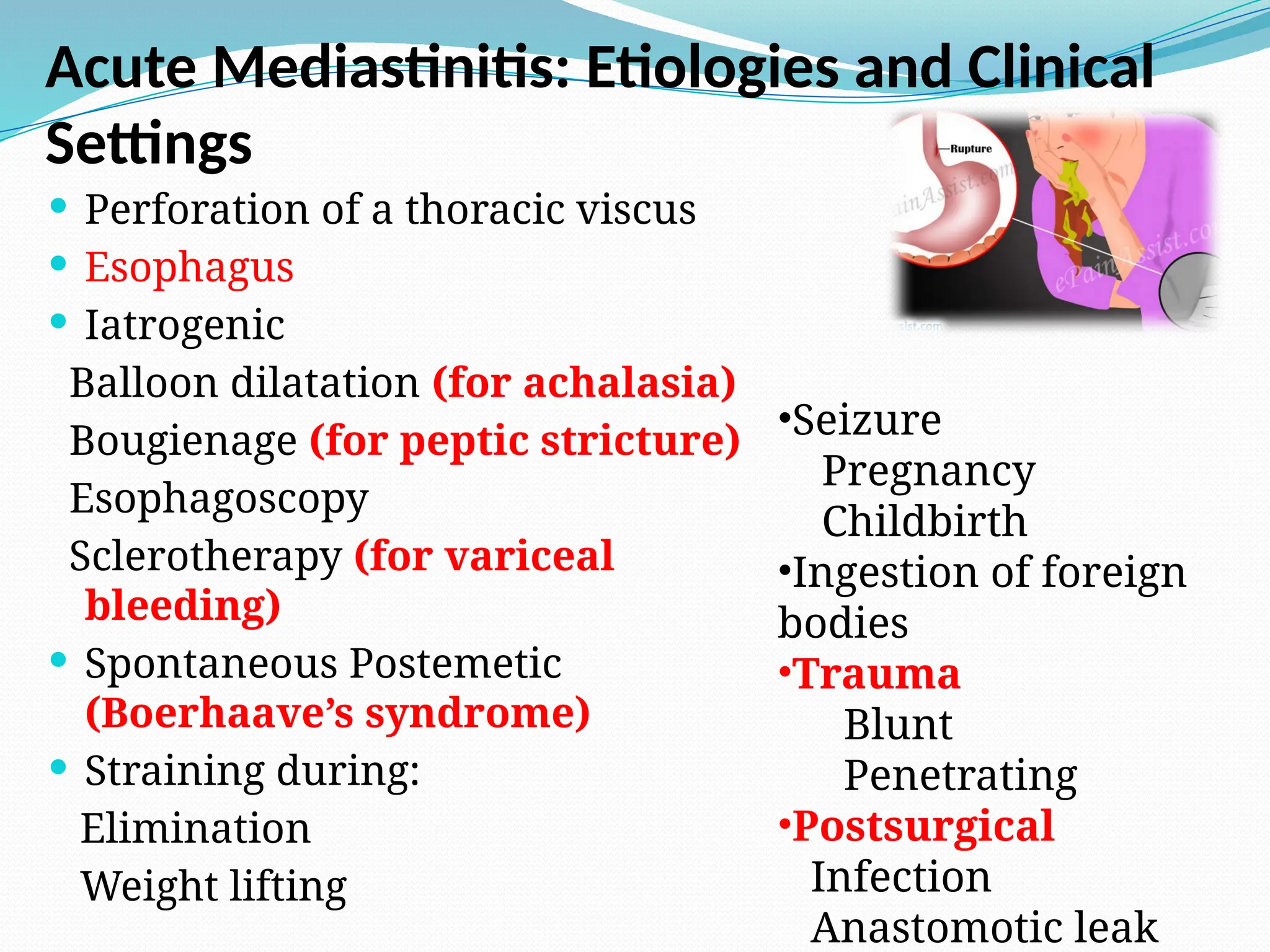ACUTE MEDIASTINITIS dinakaran m.b.b.s.pptx