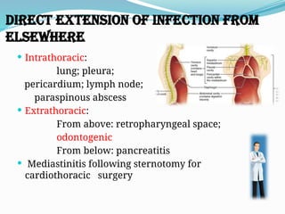 ACUTE MEDIASTINITIS dinakaran m.b.b.s.pptx