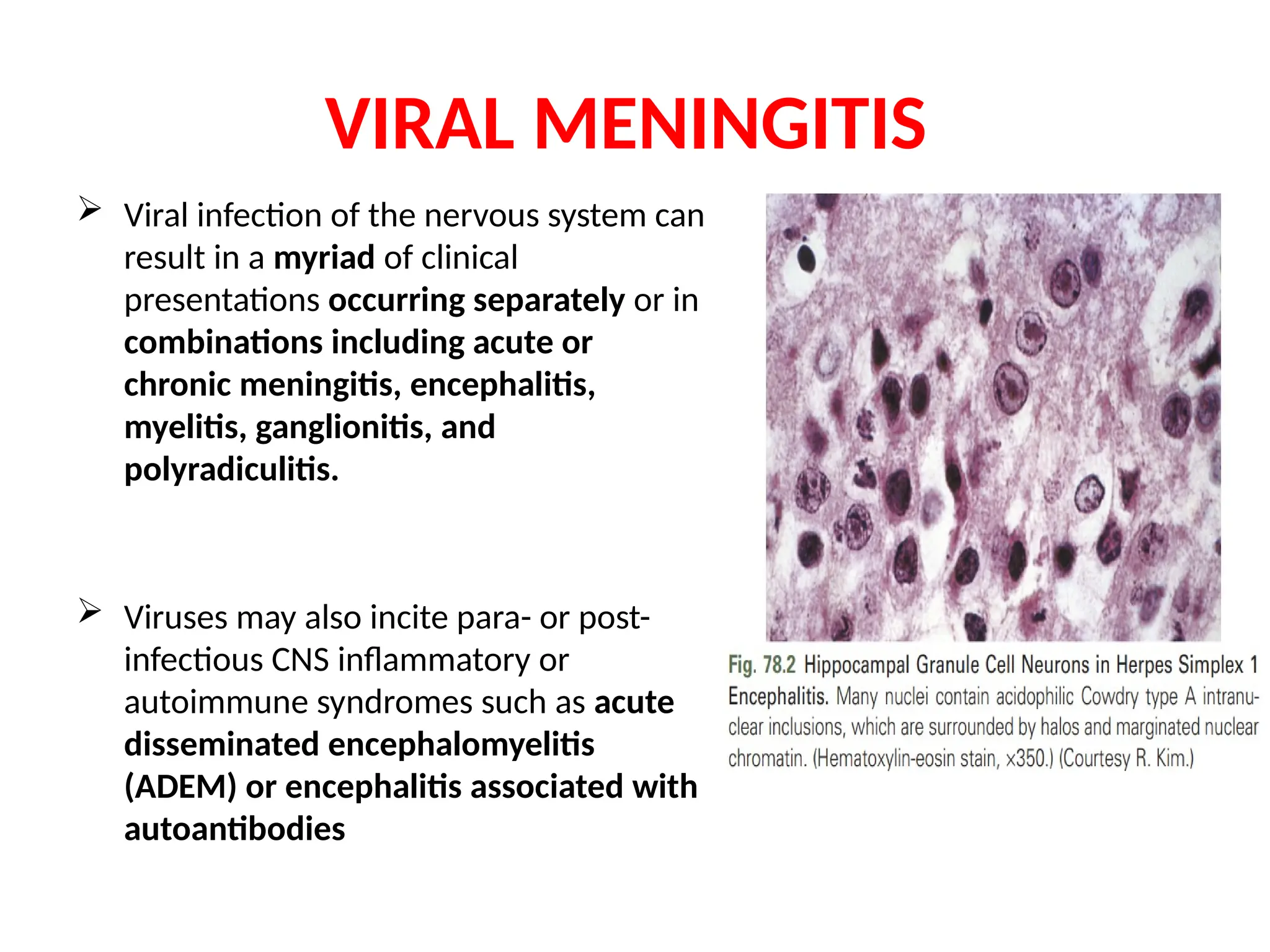 acute meningitis .pptxbxkxmcmcmcmccmcmmcm | PPTX