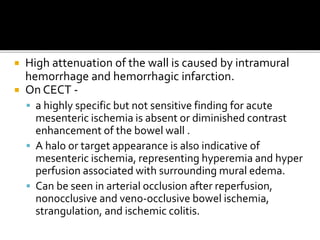 CT diagnosis of Acute mesenteric ischemia from various causes | PPTX