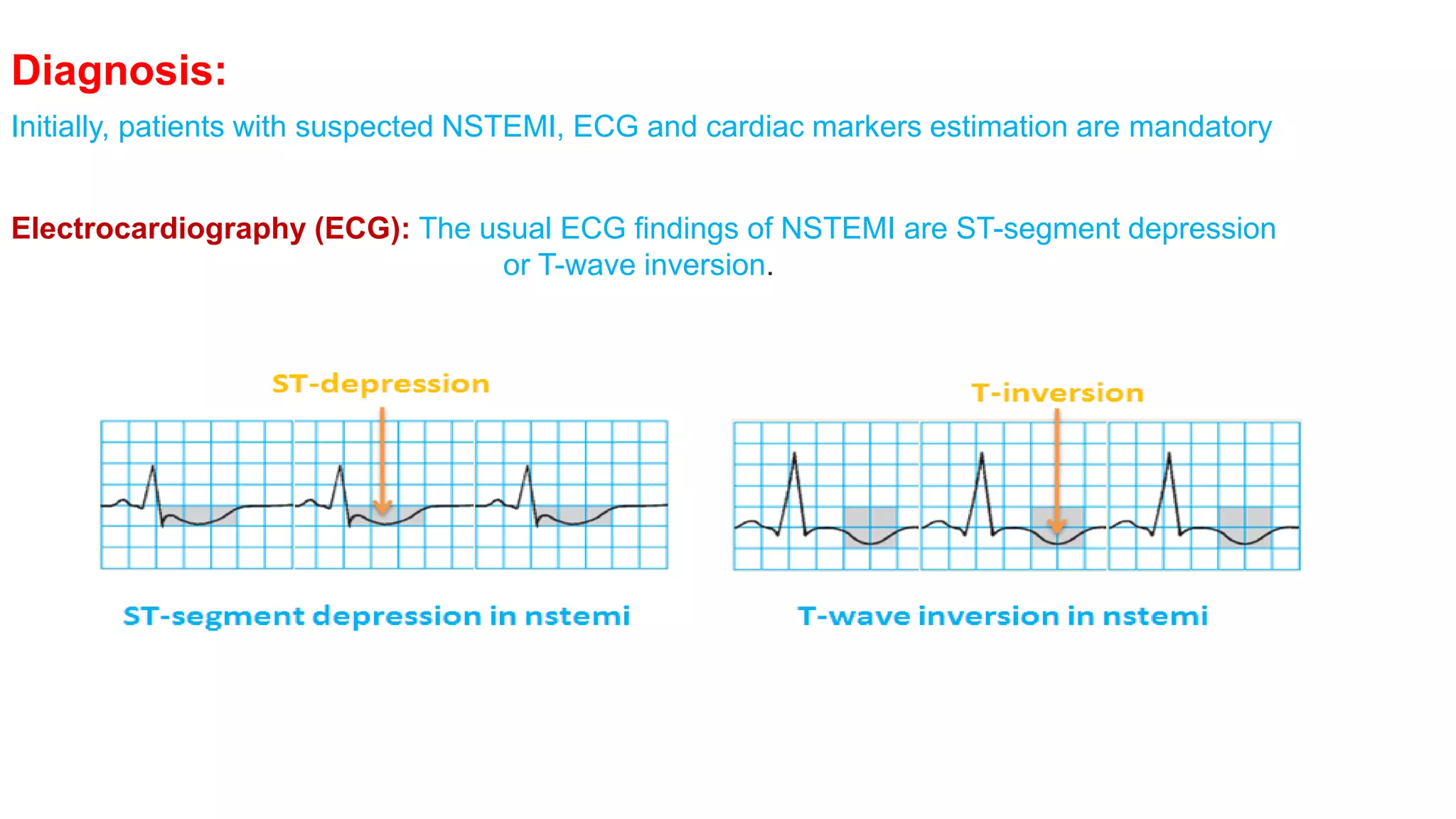 Acute MI - NSTEMI | PPTX
