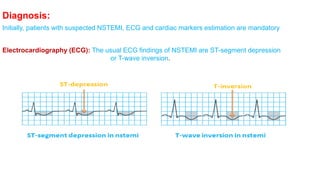 Acute MI - NSTEMI | PPTX