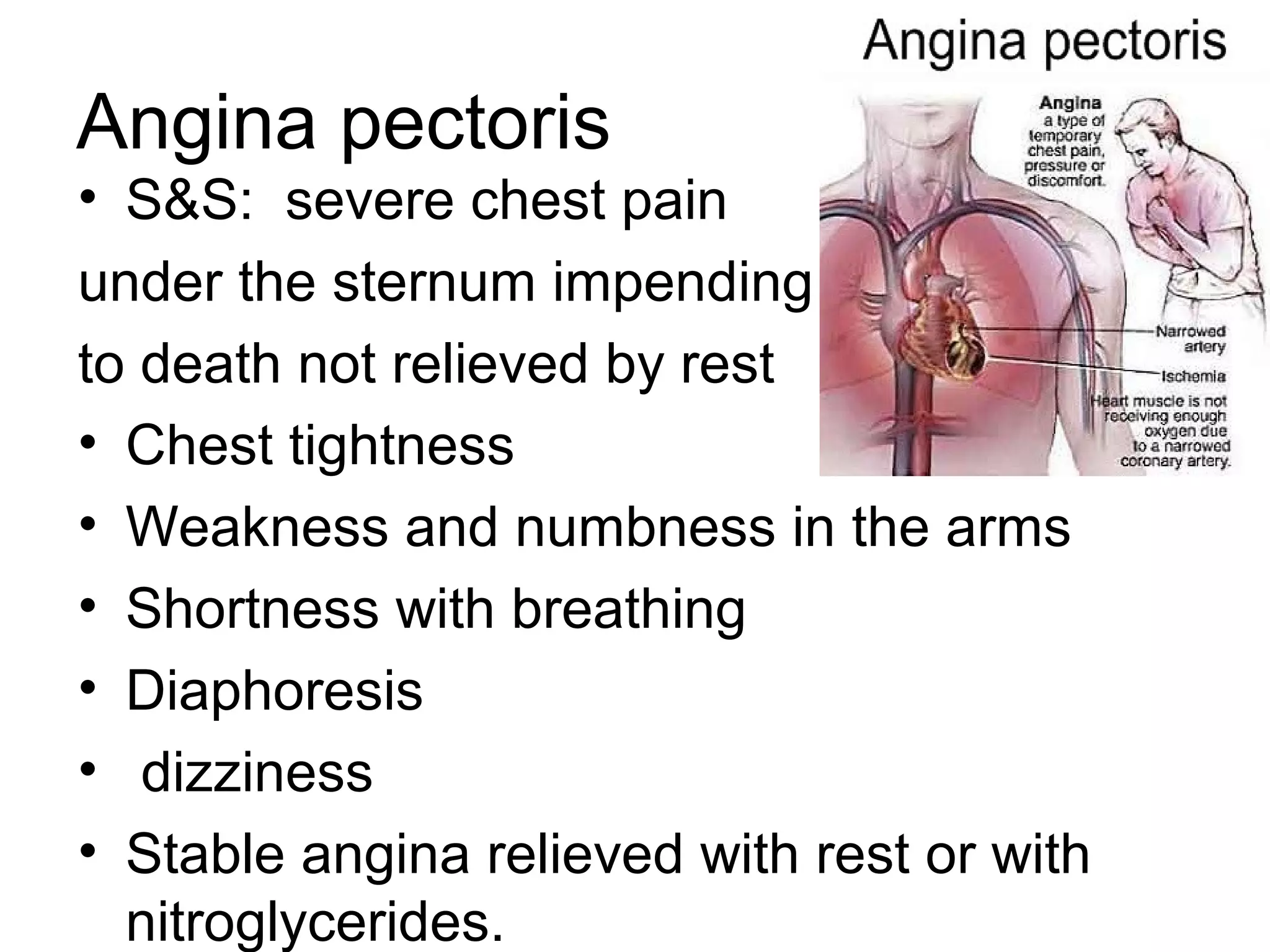 Acute MI Myocardial Infarction | PPT | Heart and Cardiovascular ...