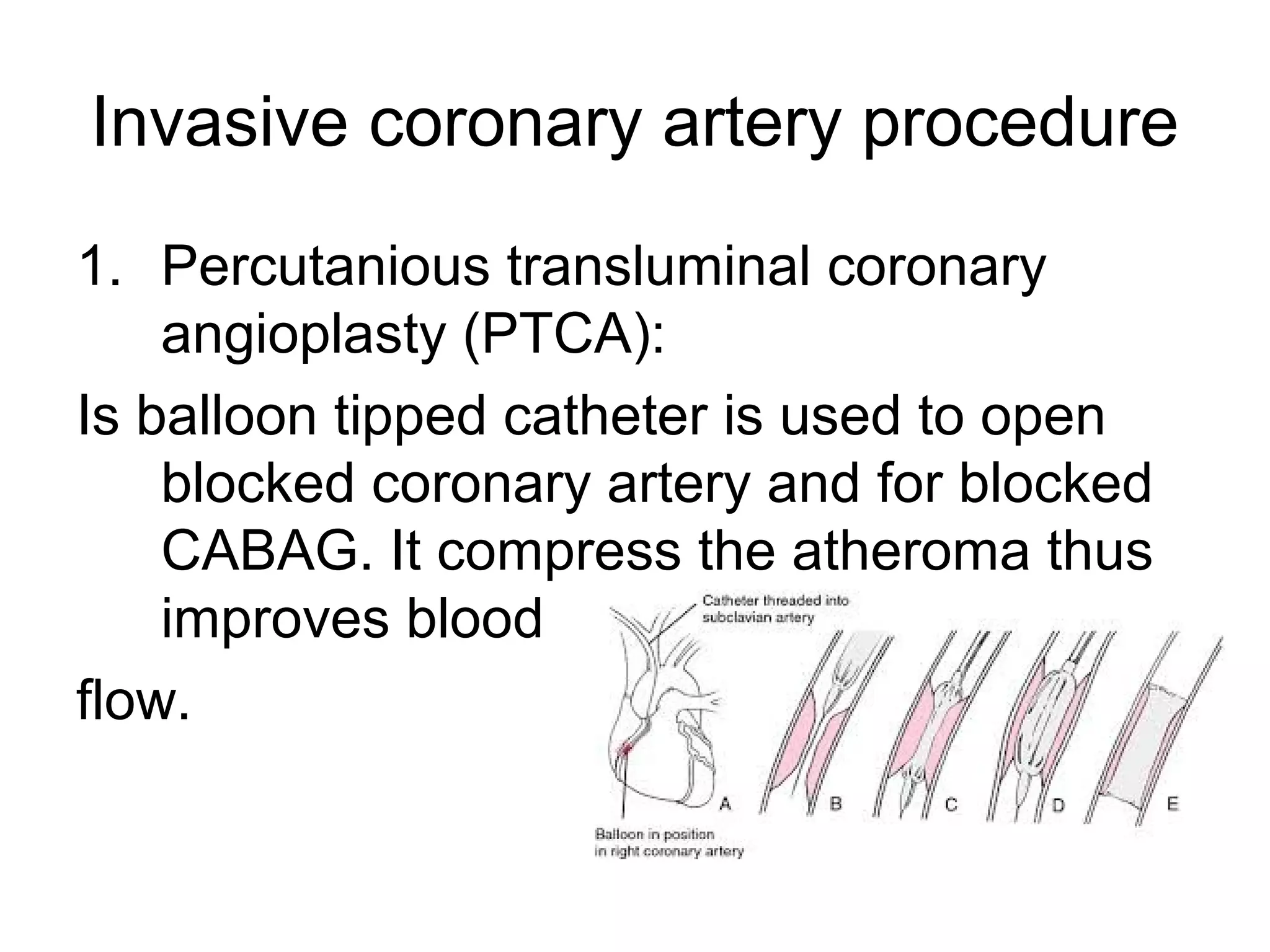 Acute MI Myocardial Infarction | PPT | Heart and Cardiovascular ...