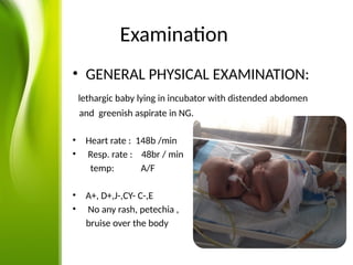 ACUTE MIDGUT VOLVULUS in children ppt.pptx
