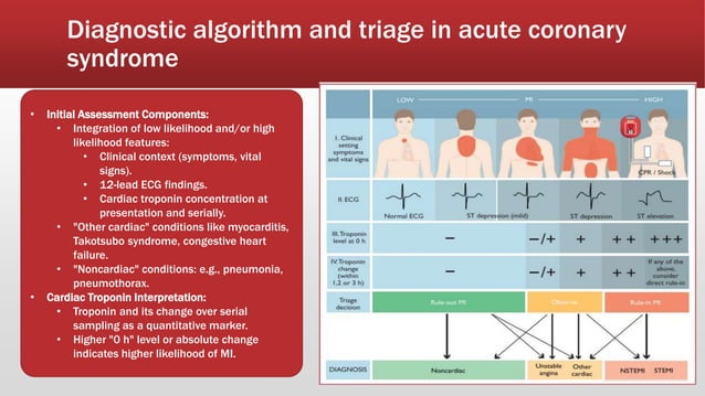 Acute MI management - ver 1.pptx | Heart and Cardiovascular Diseases ...