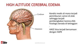 Acute mountain sickness | PPT