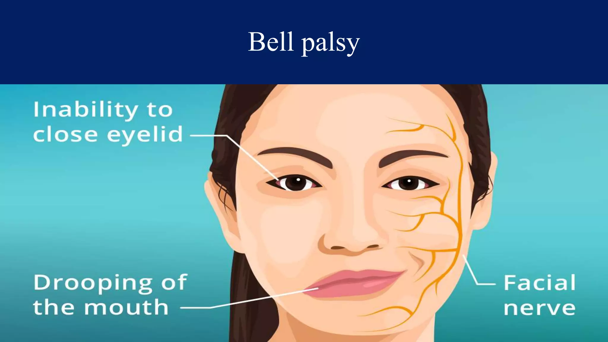 Acute multiple Oral ulcers | PPTX