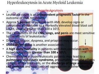 Acute Myelogenous Leukaemia | PPT