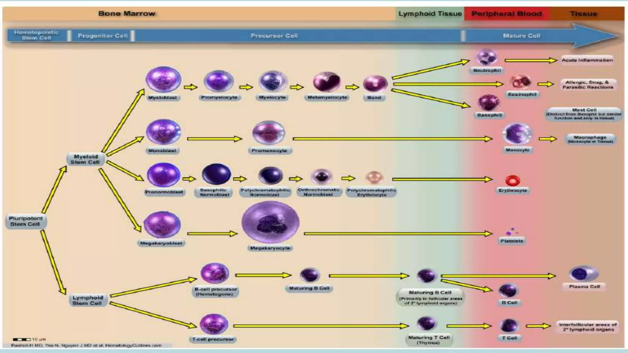Acute myeloid leukaemia | PPTX