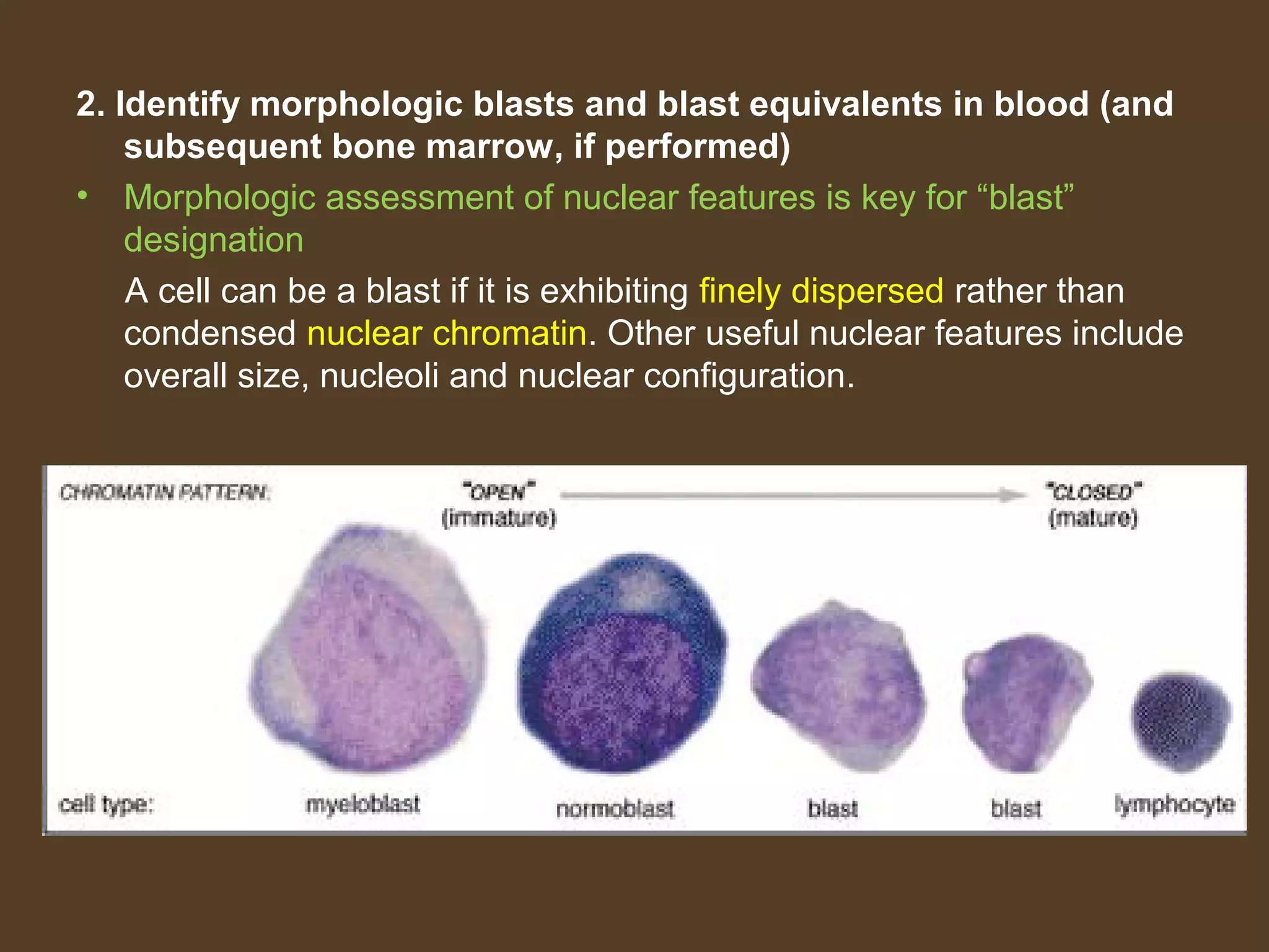 Acute myeloid leukemia | PPT