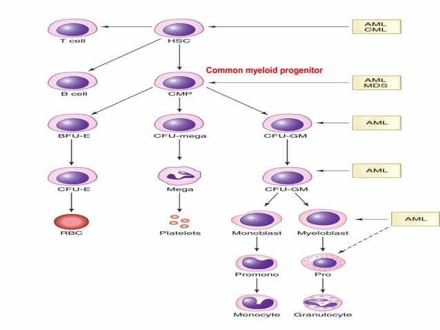 Acute myeloid leukemia
