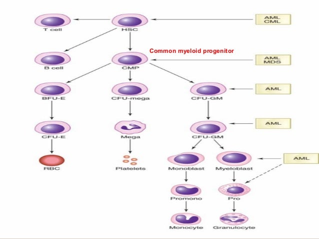 Acute myeloid leukemia