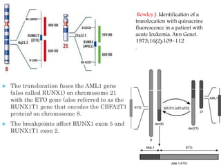 Acute myeloid leukemia | PPTX