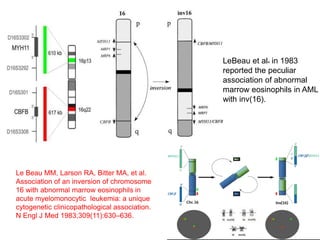 Acute myeloid leukemia | PPTX