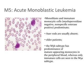 Monoblastic Leukemia