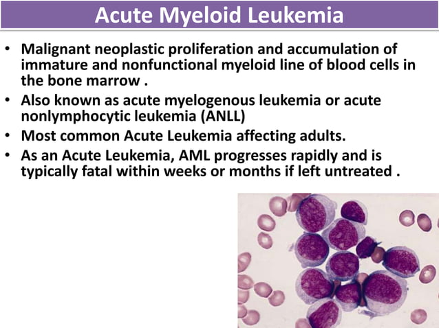 Acute Myeloid Leukemia | PPT