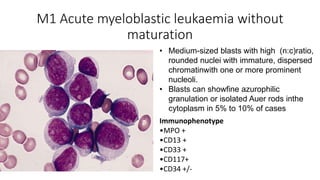 ACUTE MYELOID LEUKEMIA.pptx