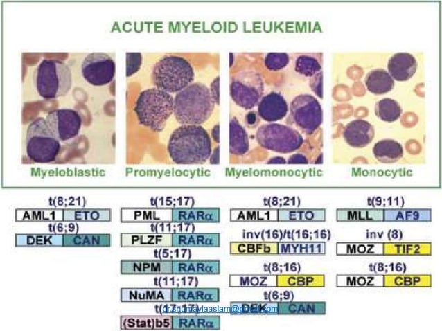 acute myeloid leukemia - neoplastic disease.pptx