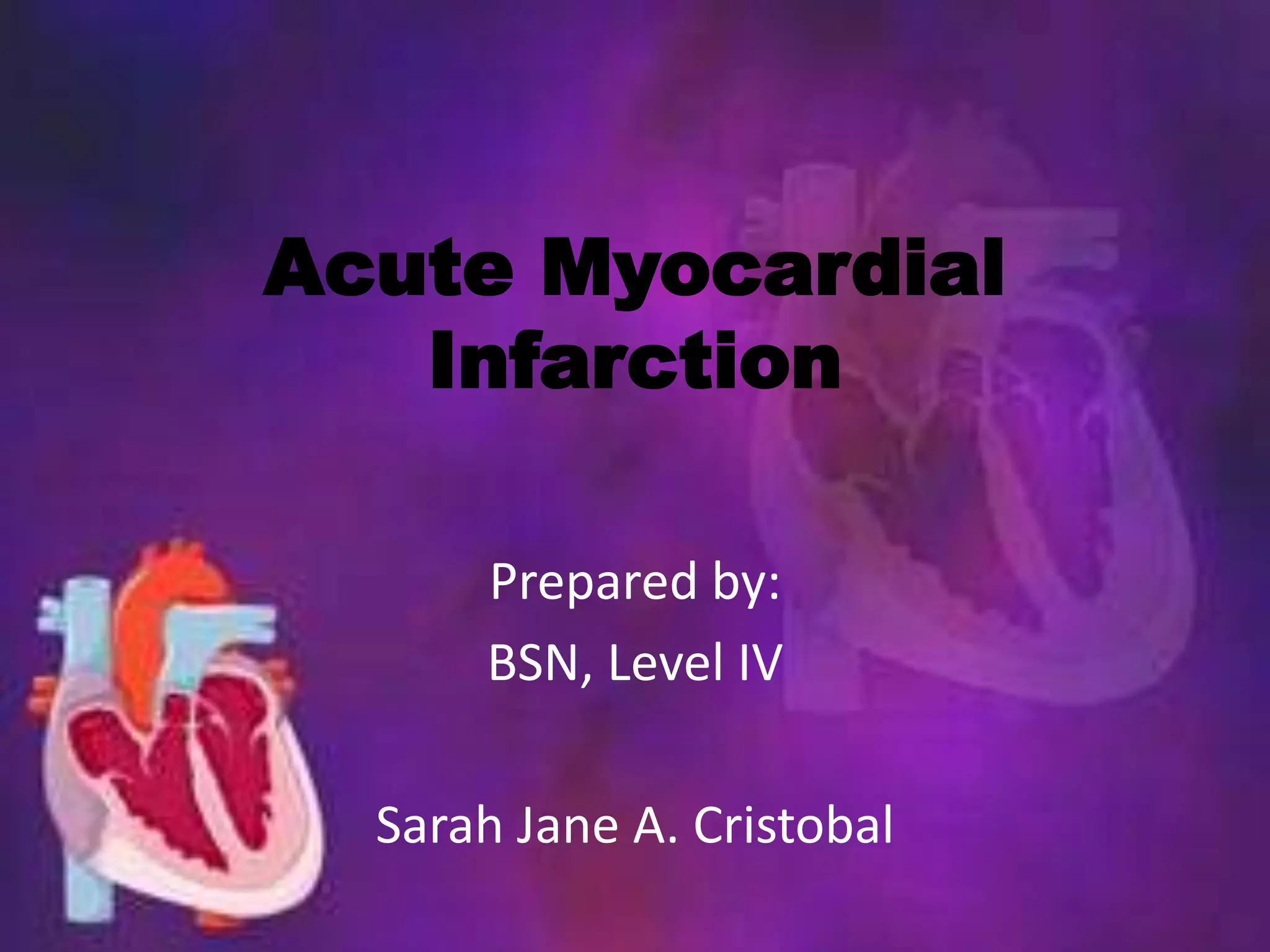 Acute myocardial infarction | PPT
