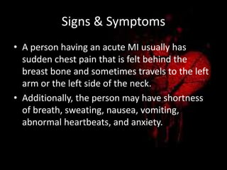Acute myocardial infarction | PPT