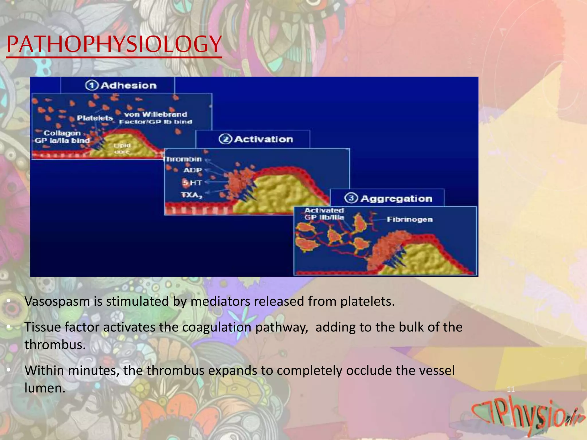Acute myocardial Infarction | PPTX