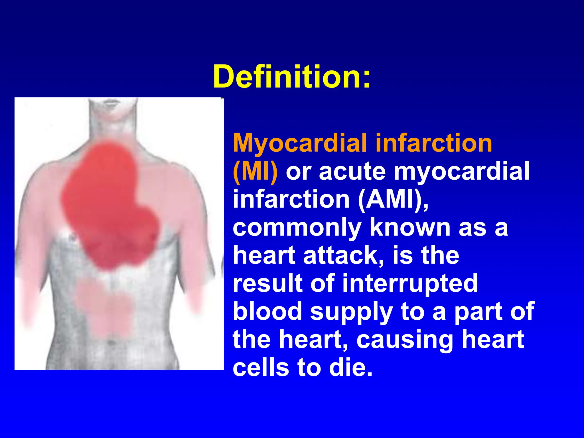 Acute coronary syndrome. Diagnosis, treatment and prophylaxis of ...