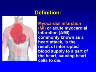 Acute coronary syndrome. Diagnosis, treatment and prophylaxis of ...