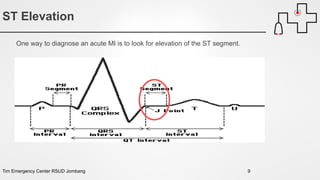 Acute Myocardial Infarction Infarction.pptx