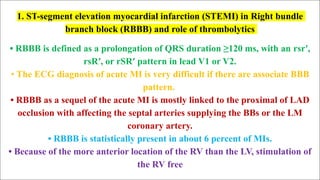 Acute myocardial infarction associated with right bundle branch block ...