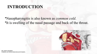 ACUTE NASOPHARYNGITIS. pptx | PPTX