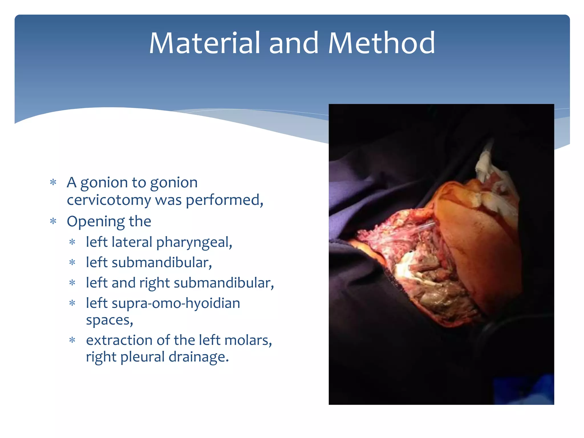 Acute necrotic descendent mediastinitis | PPTX
