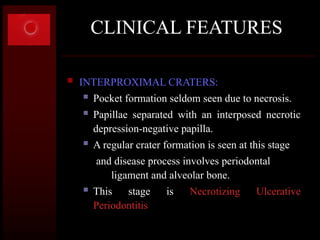 Acute necrotising ulcerative gingivitis.pptx