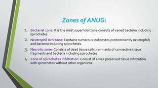 Acute Necrotizing Ulcerative Gingivitis.pptx