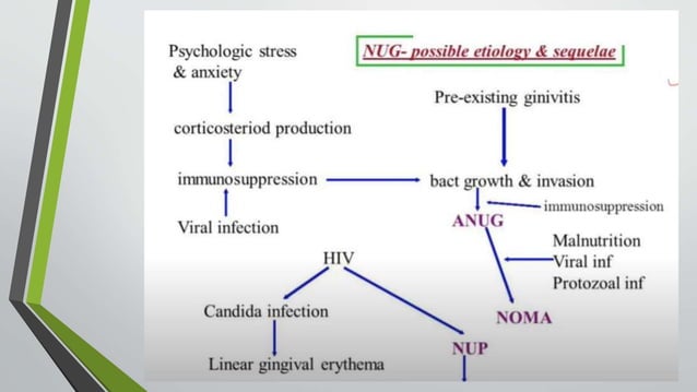 Acute Necrotizing Ulcerative Gingivitis.pptx | Dental Health | Diseases ...