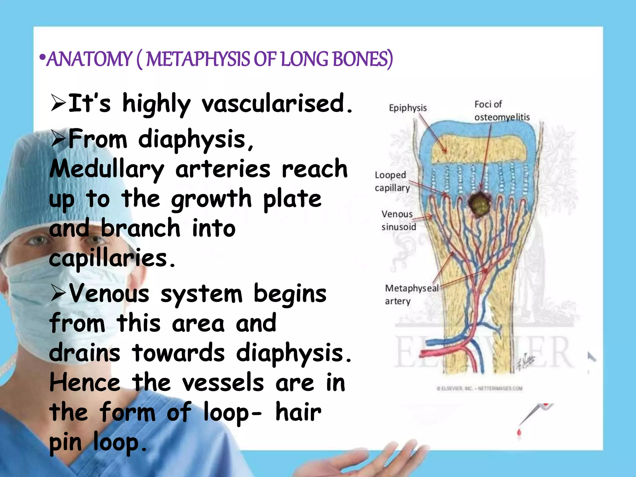 Acute osteomyelitis | PPTX
