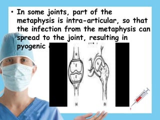 Acute osteomyelitis | PPTX