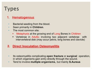 acuteosteomyelitis-.pptx