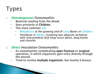 Acute osteomyelitis | PPT