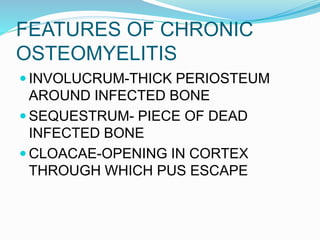 Acute osteomyelitis | PPT
