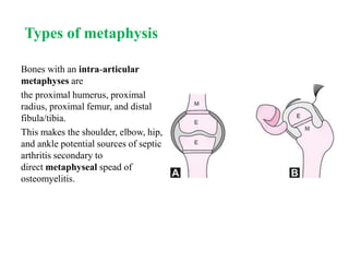 Acute oooooooooooooooooooooooooooooooooooooo(2).pptx