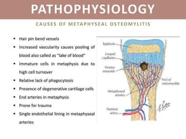 acute osteomyelitis ppt.pptx2.pptx