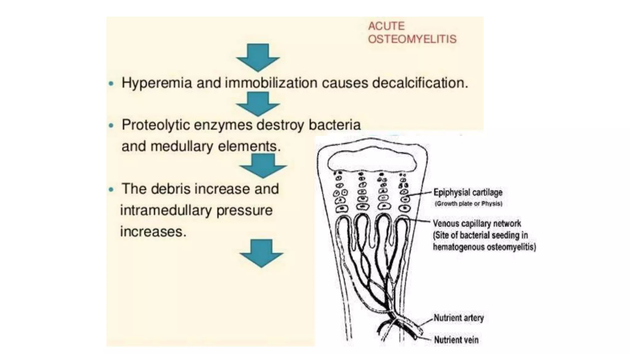 ACUTE OSTEOMYELITIS PPT.pptx