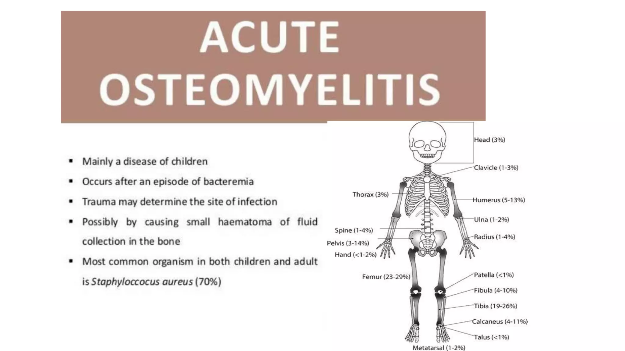 ACUTE OSTEOMYELITIS PPT.pptx