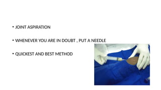 ACUTE OSTEOMYELITIS SEPTIC ARTHRITIS AND TOM SMITH ARTHRITIS.pptx