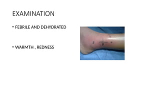 ACUTE OSTEOMYELITIS SEPTIC ARTHRITIS AND TOM SMITH ARTHRITIS.pptx