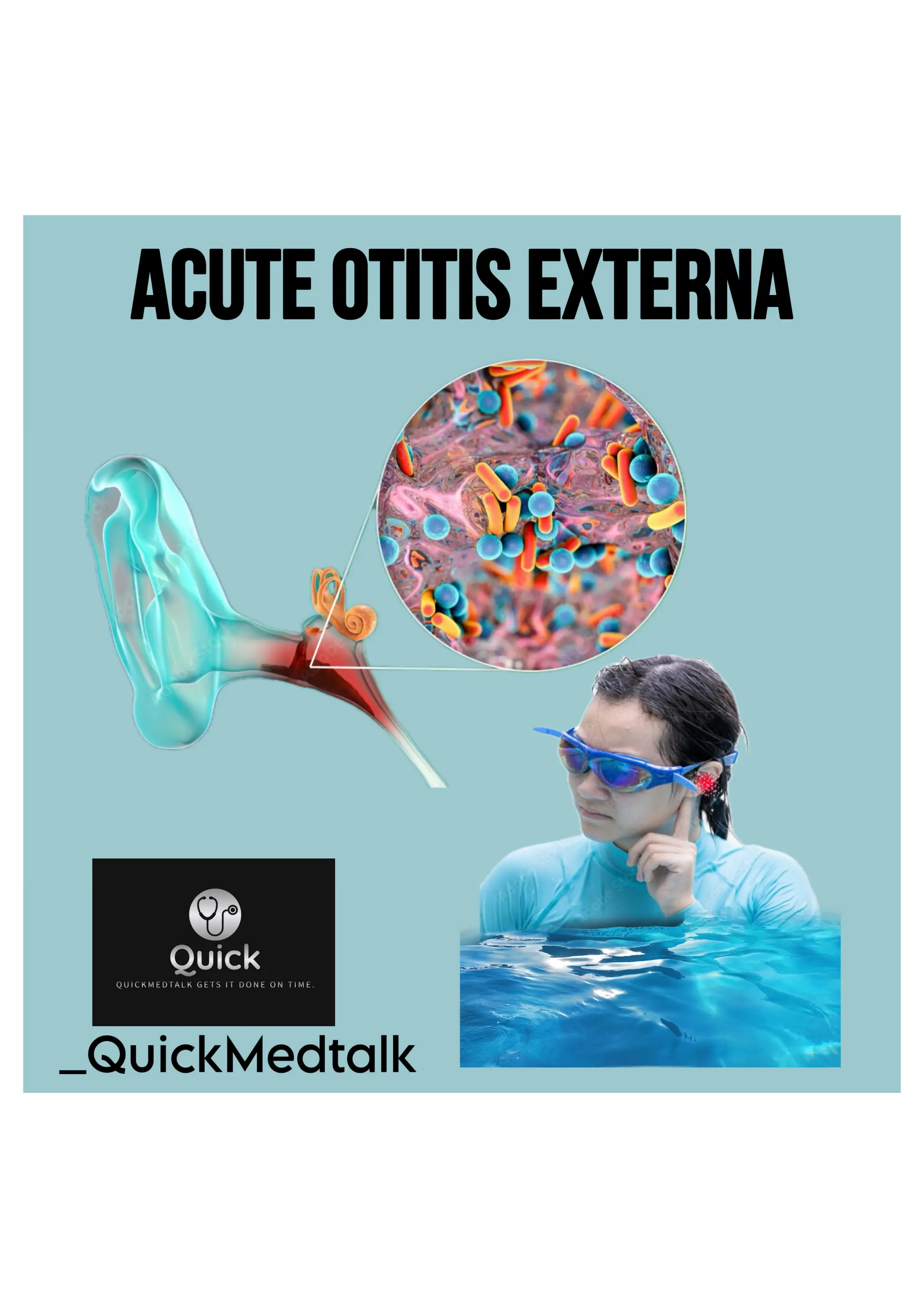 Acute otitis externa.pdf ENT BY QUICKMEDTALK | PDF